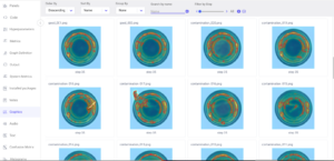 Computer Vision | Comet